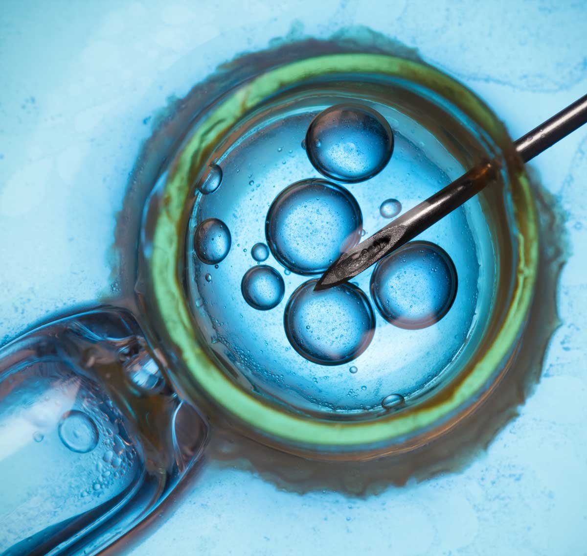 Intellectual Property Law & Biotechnology Patents | Wolf Greenfield